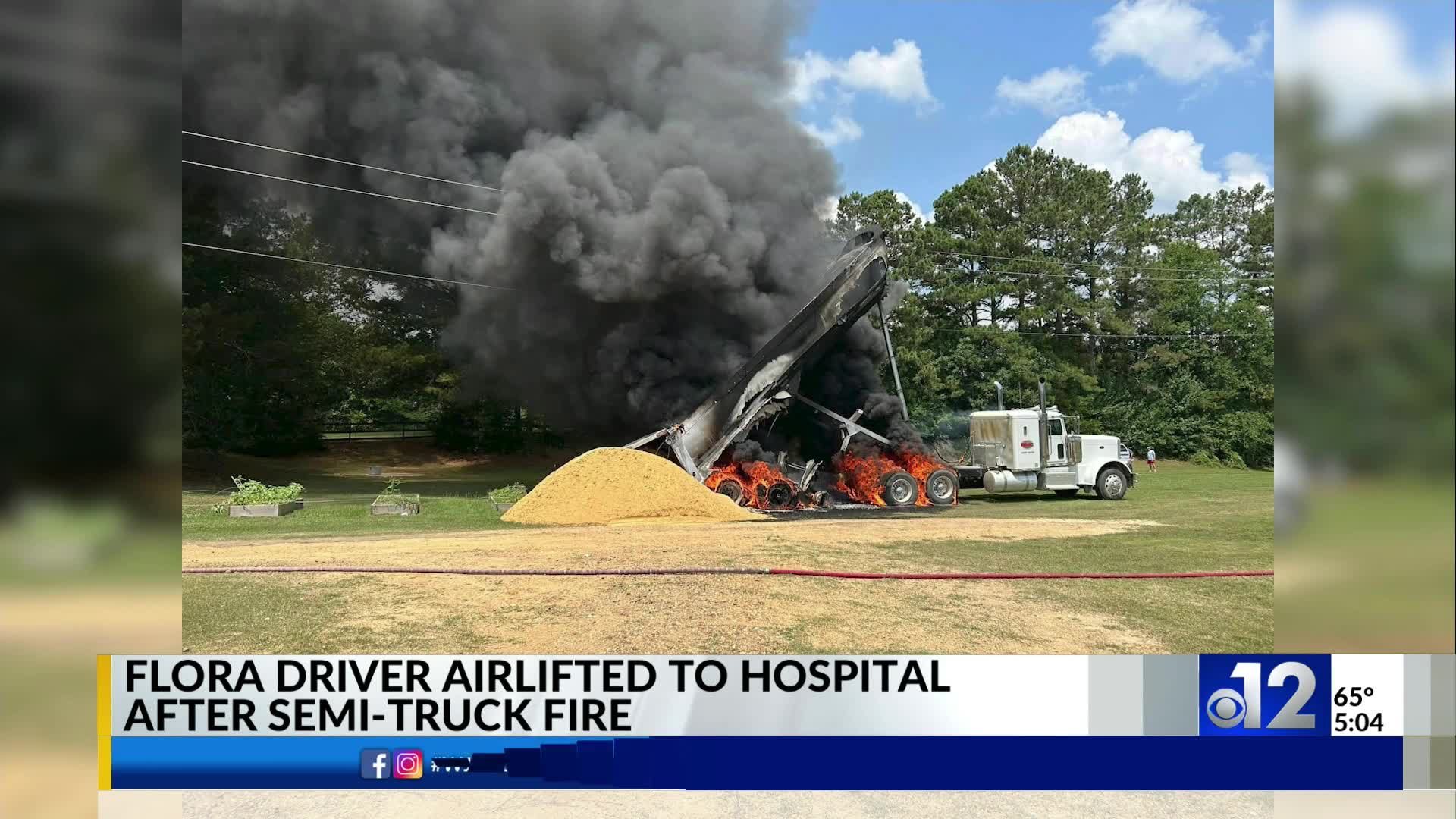 Flora driver airlifted to hospital after semi-truck fire – WJTV