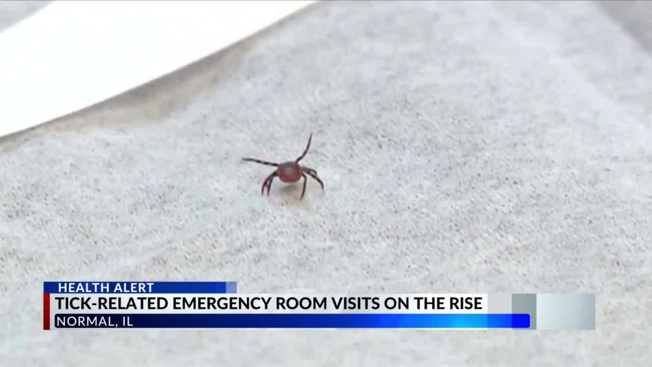 CDC reports rise in tick-related ER visits in Midwest – CIProud.com