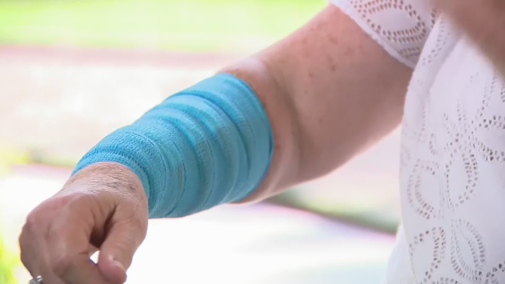 Texas woman injured after hawk drops snake on her arm, then attacks ...