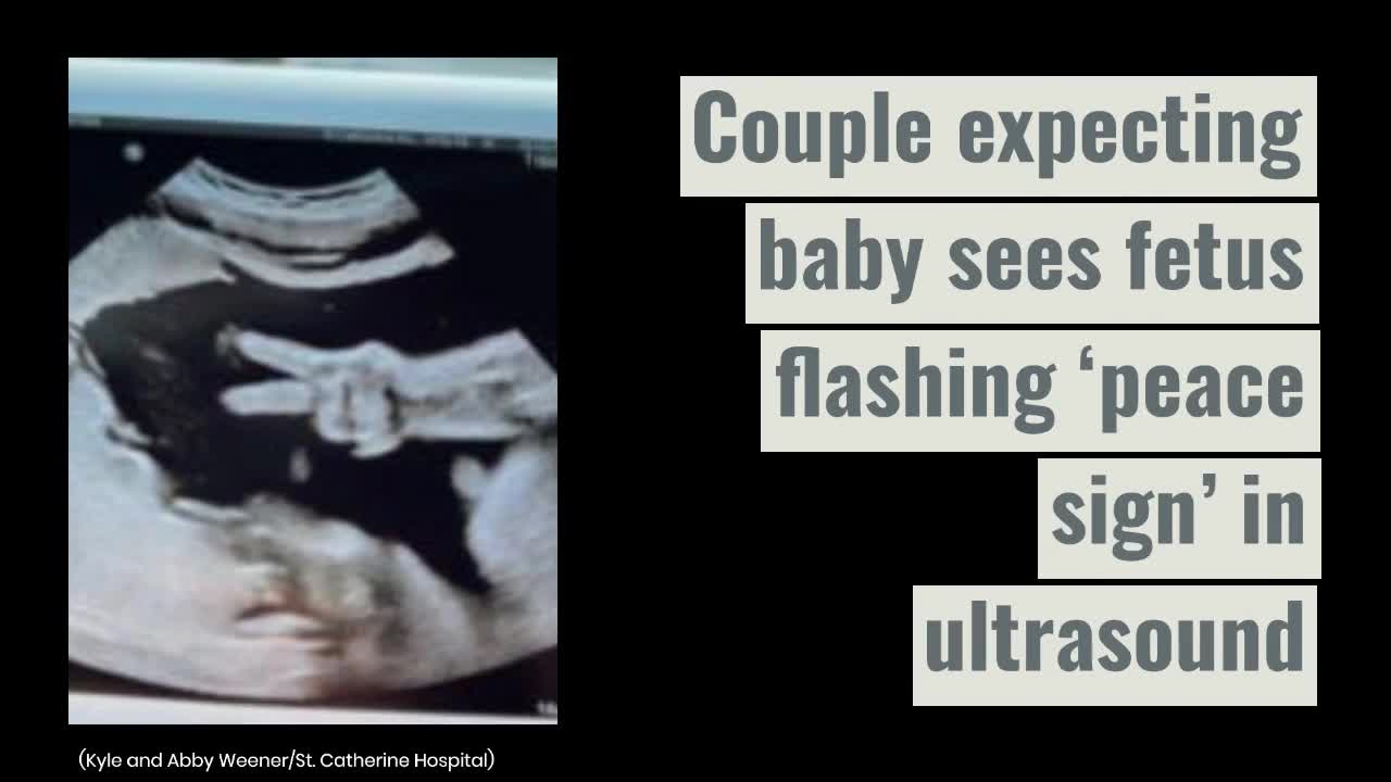 Couple expecting baby sees fetus flashing ‘peace sign’ in ultrasound ...