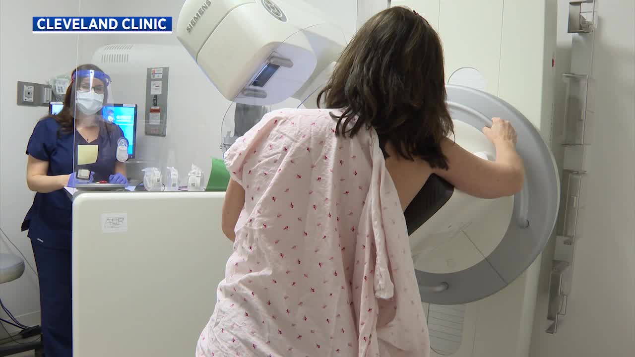 Why are mammogram guidelines changing? – Fox 8 Cleveland WJW